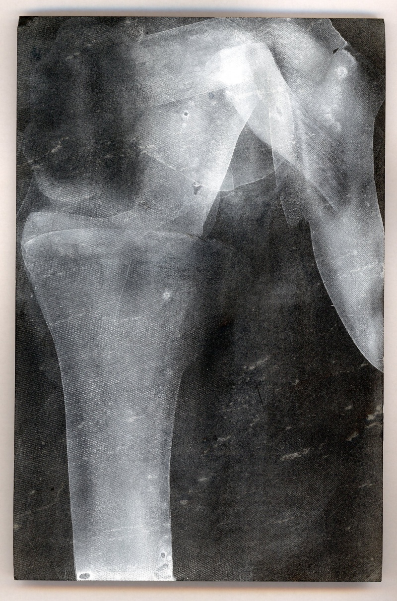 Harcum Gallery Exhibit to Feature Unique Exhibit of X-Ray Art ...